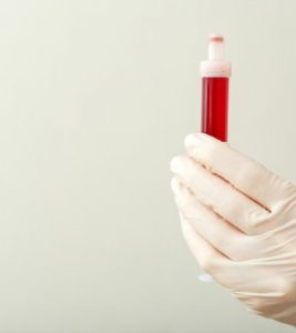 HCM: ¿Qué significa en un análisis de sangre? - Salud.Asturias24.es
